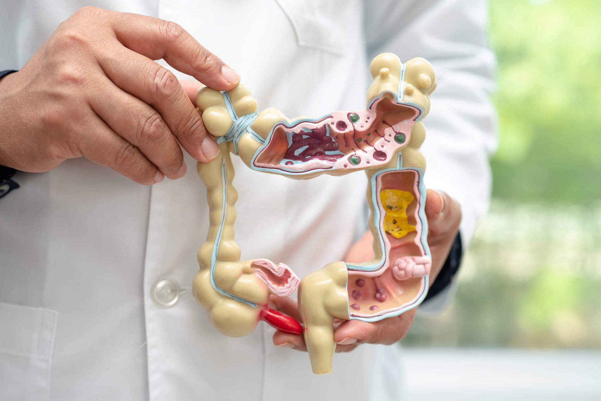 Colon Therapy – MMC Polyclinic and Hospital